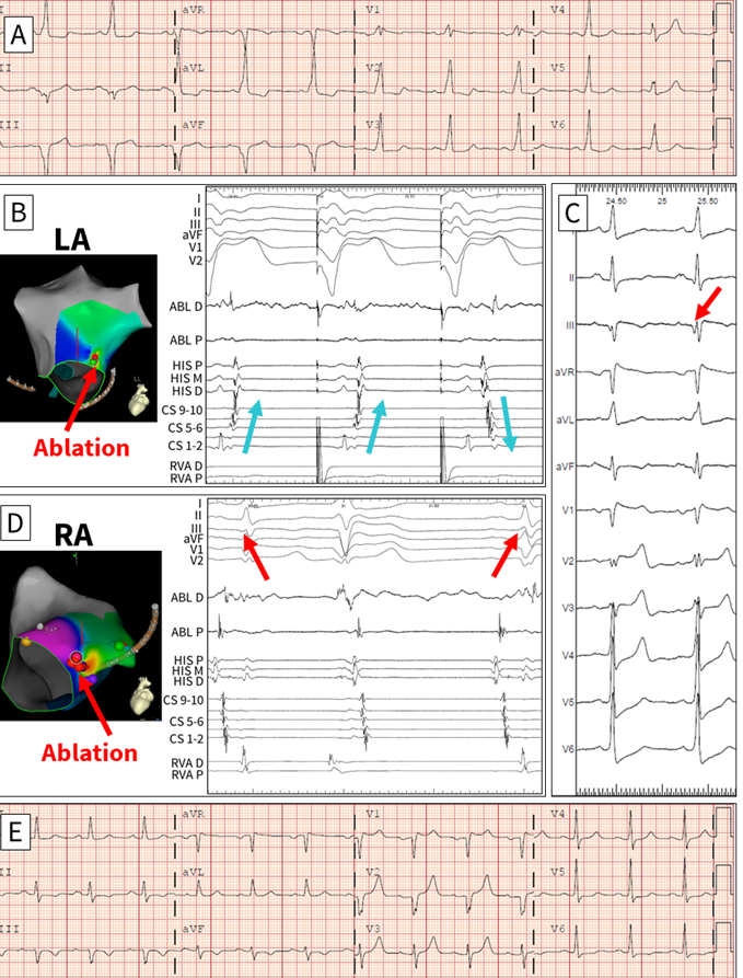 Home - Arrhythmia Alliance