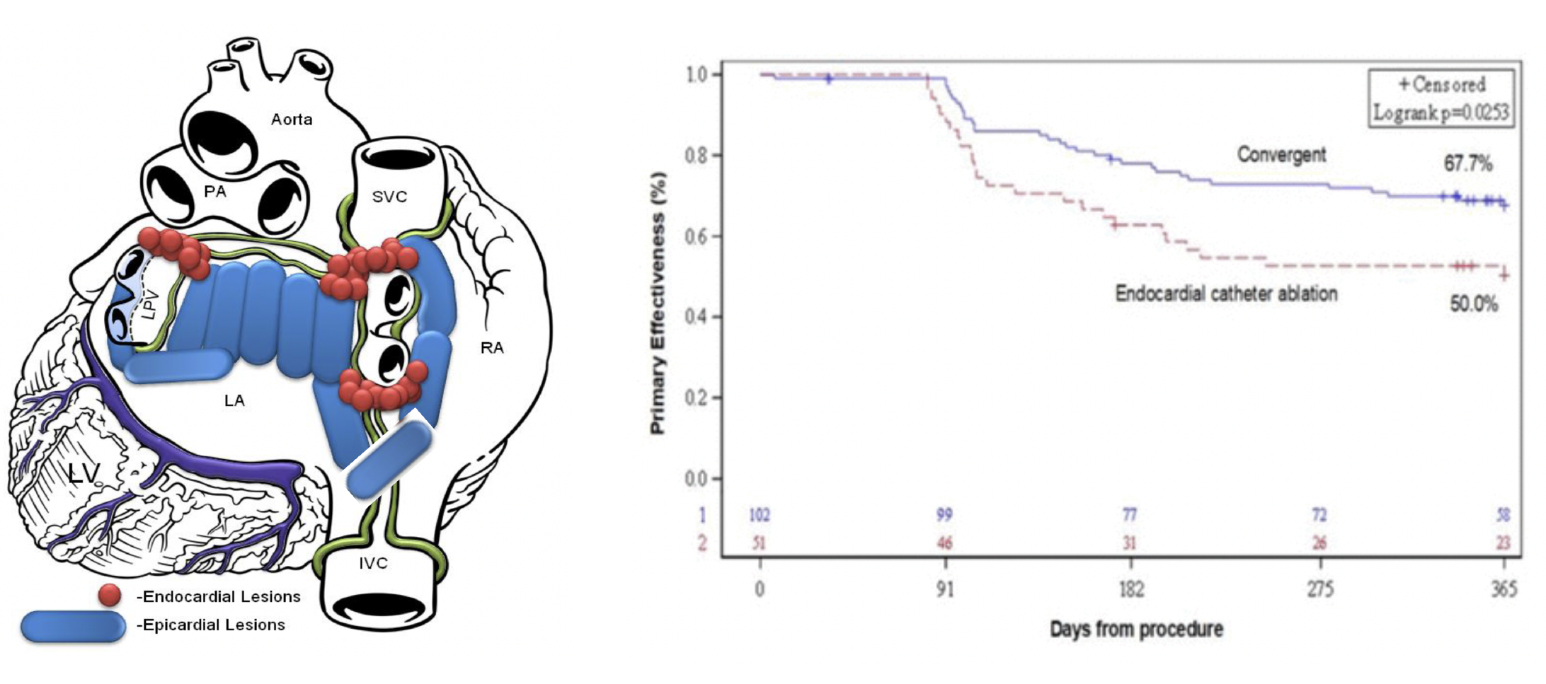 Home - Arrhythmia Alliance