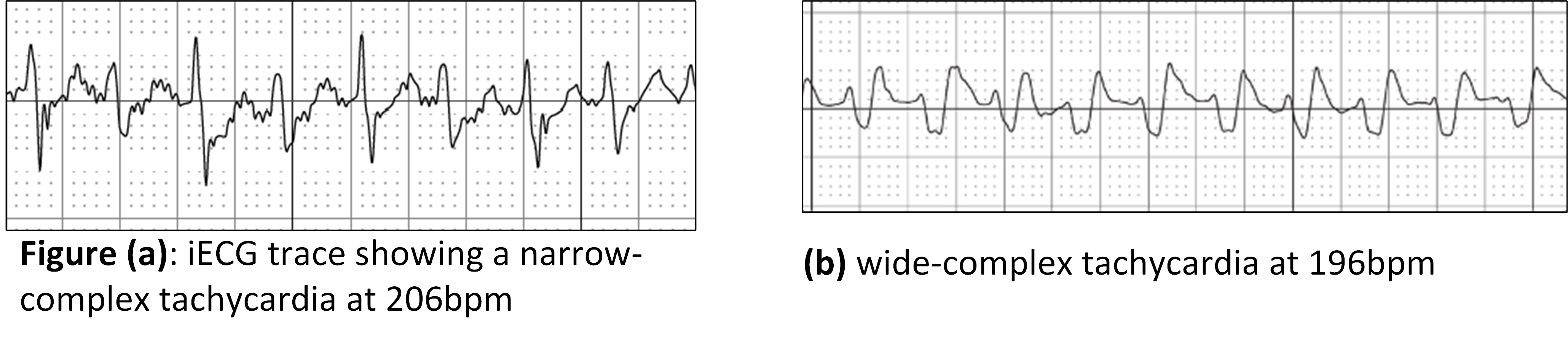 Home - Arrhythmia Alliance