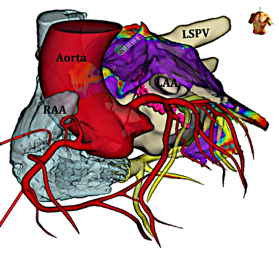 Home - Arrhythmia Alliance
