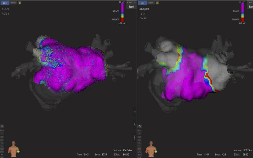 Home - Arrhythmia Alliance