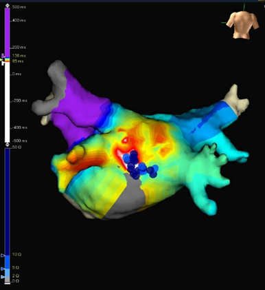 Home - Arrhythmia Alliance